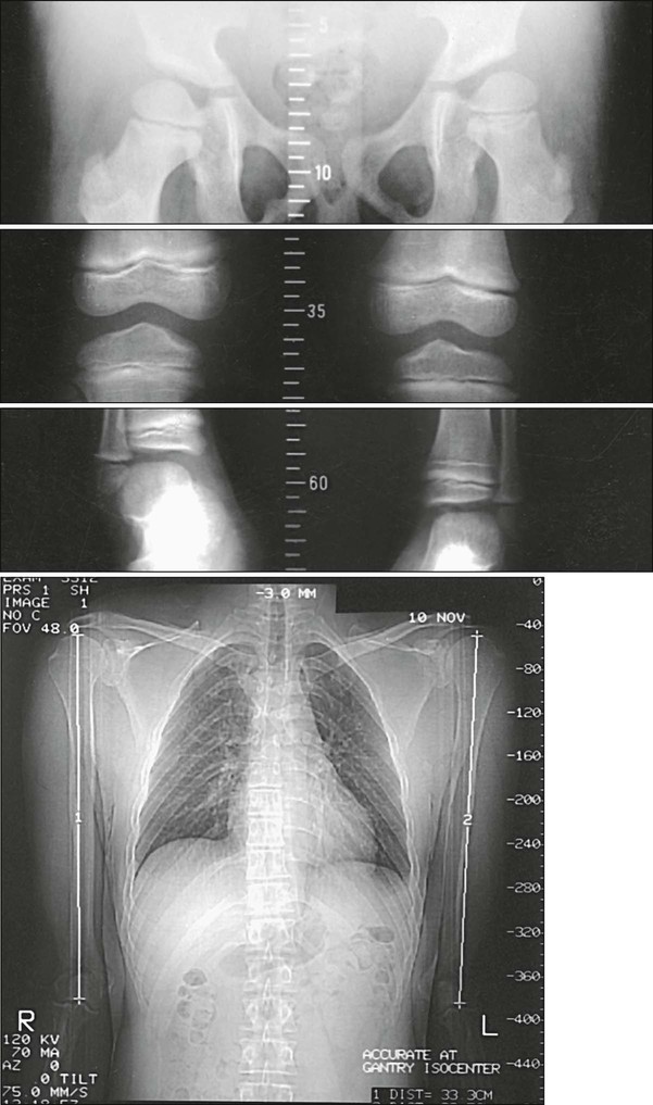 Merrill's Atlas of Radiographic Positioning & Procedures