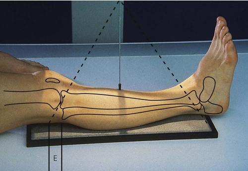Merrill's Atlas of Radiographic Positioning & Procedures