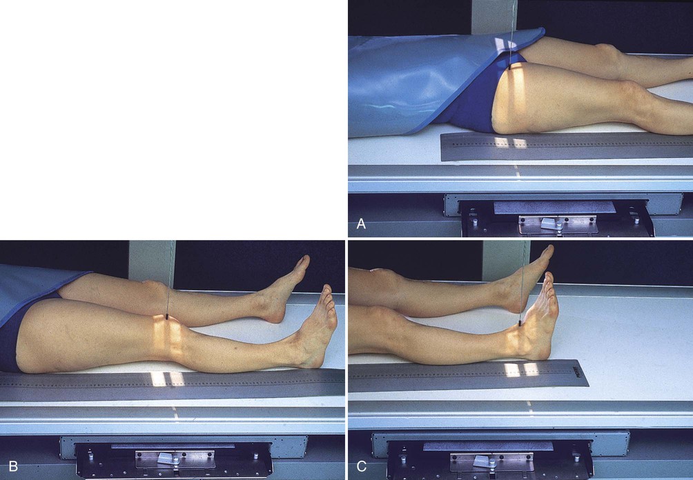Merrill's Atlas of Radiographic Positioning & Procedures