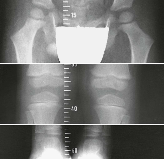 Merrill's Atlas of Radiographic Positioning & Procedures