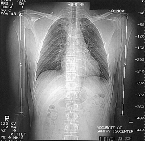 Merrill's Atlas of Radiographic Positioning & Procedures