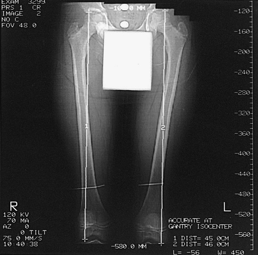 Merrill's Atlas of Radiographic Positioning & Procedures