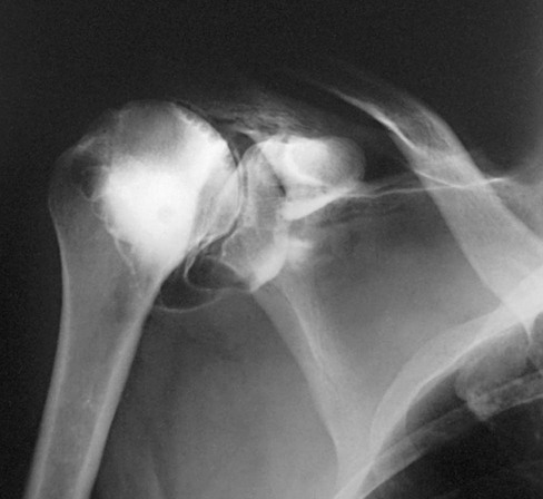 Merrill's Atlas of Radiographic Positioning & Procedures