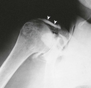 Merrill's Atlas of Radiographic Positioning & Procedures