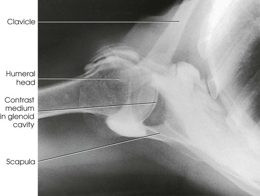 Merrill's Atlas of Radiographic Positioning & Procedures