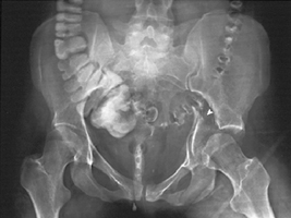 Merrill's Pocket Guide to Radiography