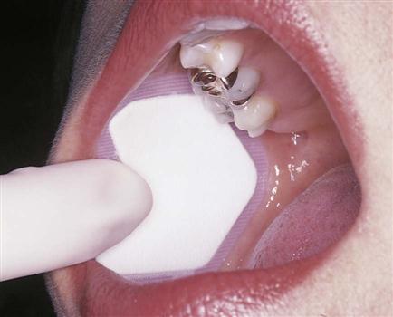 Essentials of Dental Assisting