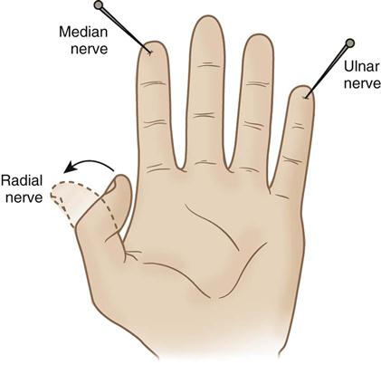 Alexander's Care of the Patient in Surgery