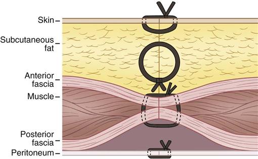 Alexander's Care of the Patient in Surgery