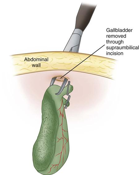 Alexander's Care of the Patient in Surgery