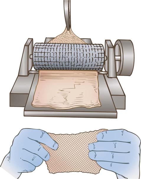 Alexander's Care of the Patient in Surgery