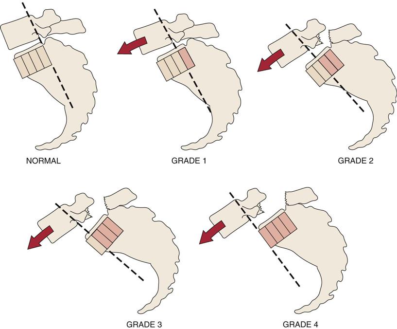 Orthopedic Physical Assessment