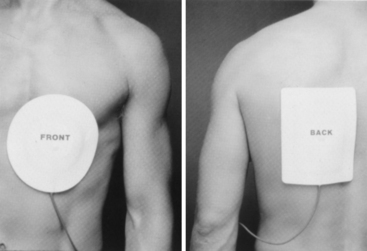 Anesthesia Equipment: Principles and Applications