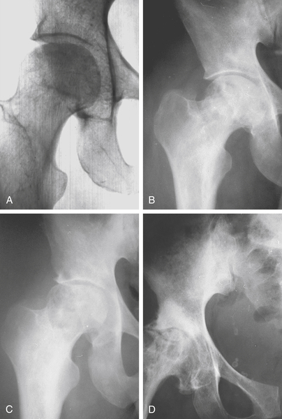 A Manual of Orthopaedic Terminology