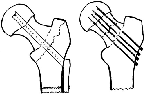 A Manual of Orthopaedic Terminology