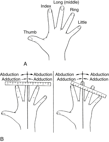 A Manual of Orthopaedic Terminology
