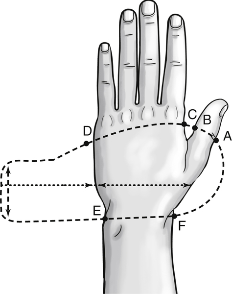 Introduction to Orthotics