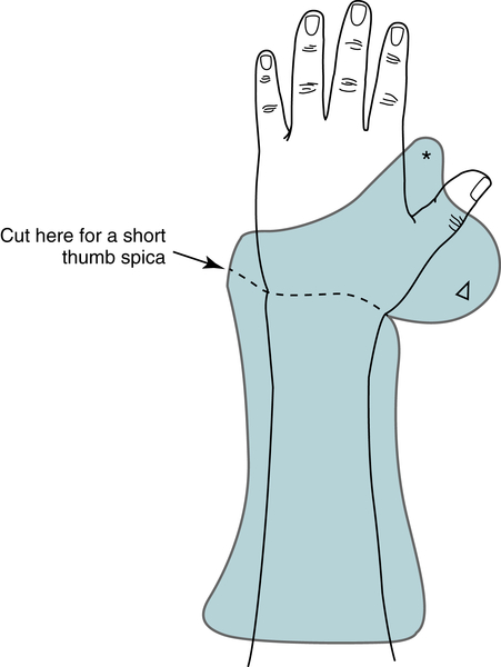 Introduction to Orthotics