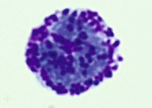 Middleton’s Allergy: Principles and Practice