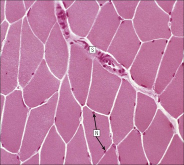 Contractile Cells