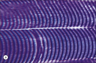 Contractile Cells