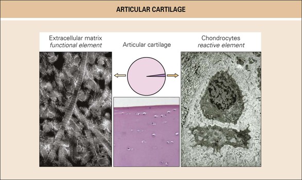 Pathogenesis and pathology of osteoarthritis