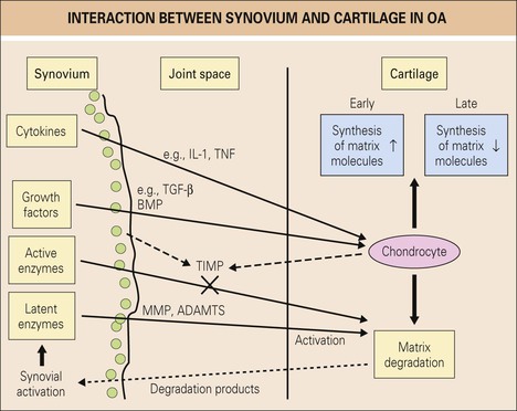 Pathogenesis and pathology of osteoarthritis