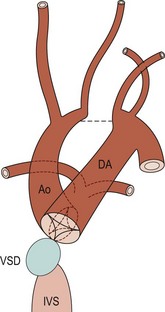 Fetal Heart Ultrasound: How, Why and When