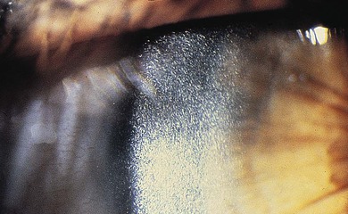 Comprehensive Clinical Nephrology