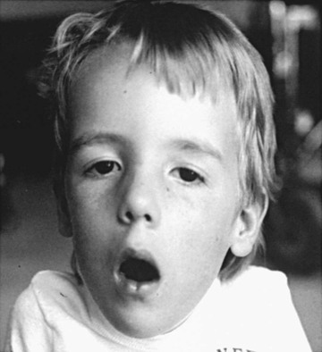 Nelson Textbook of Pediatrics