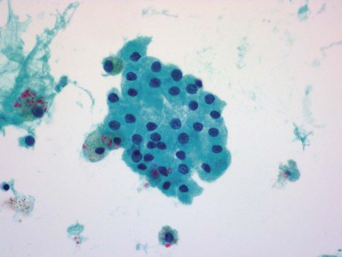 Cytopreparatory Techniques