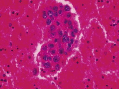 Cytopreparatory Techniques