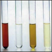 Physical Examination of Urine