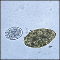 Cestodes, Trematodes, and Acanthocephalans