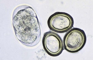 Cestodes, Trematodes, and Acanthocephalans