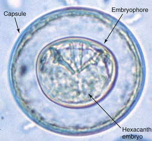 Cestodes, Trematodes, and Acanthocephalans