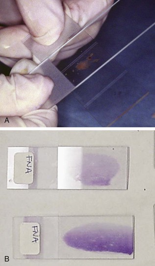 Preparation of Cytology Smears