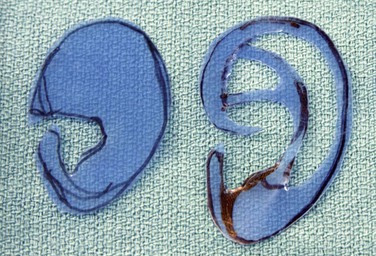 Cummings Pediatric Otolaryngology