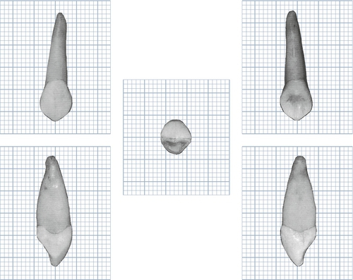 Wheeler’S Dental Anatomy, Physiology, and Occlusion