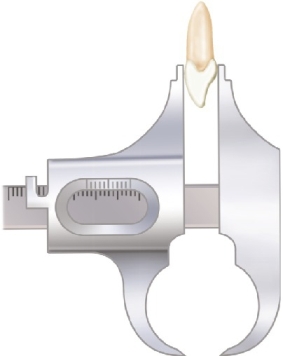 Wheeler’S Dental Anatomy, Physiology, and Occlusion