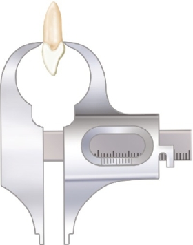 Wheeler’S Dental Anatomy, Physiology, and Occlusion