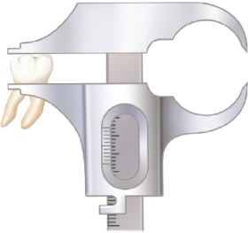 Wheeler’S Dental Anatomy, Physiology, and Occlusion