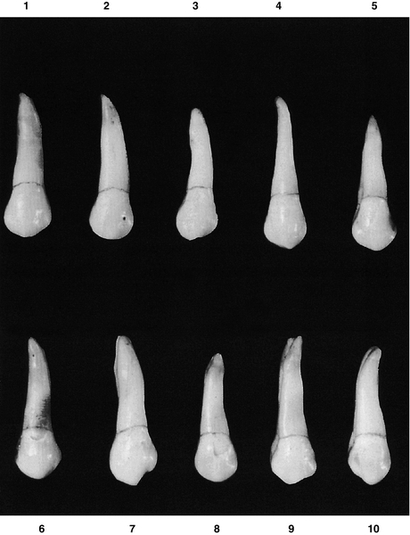 Wheeler’S Dental Anatomy, Physiology, and Occlusion