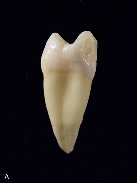 Wheeler’S Dental Anatomy, Physiology, and Occlusion