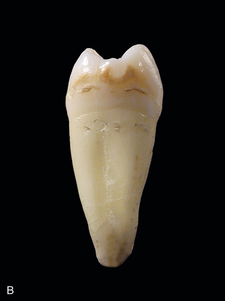 Wheeler’S Dental Anatomy, Physiology, and Occlusion