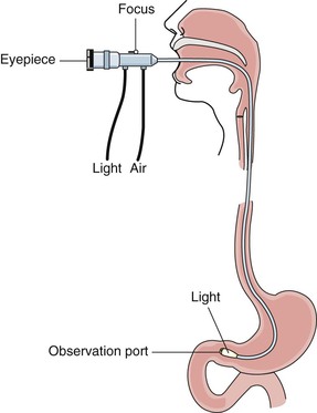 Care of the Patient With a Gastrointestinal Disorder