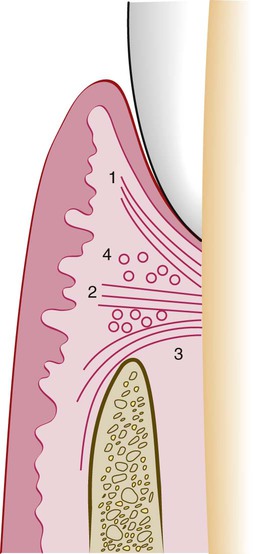 Carranza's Clinical Periodontology