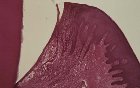 Carranza's Clinical Periodontology