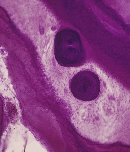 Carranza's Clinical Periodontology