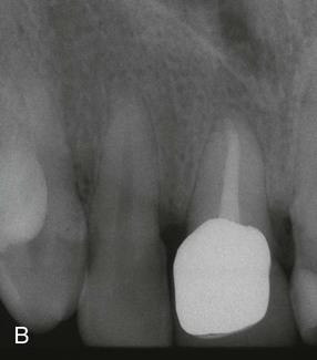 Carranza's Clinical Periodontology